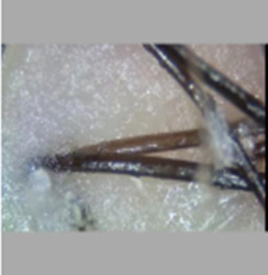 Cina Macchina portatile dell'analizzatore dell'analizzatore dei capelli dell'analizzatore della pelle di bellezza in vendita