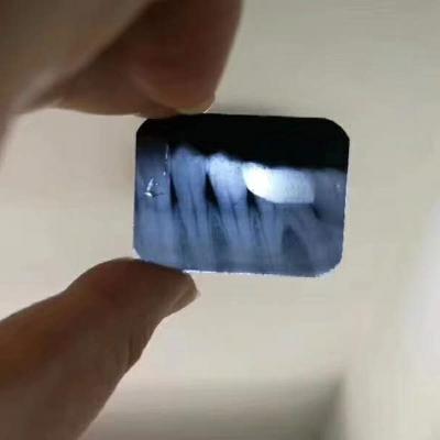 Cina Denti tenuti in mano X Ray Machine Wireless Medical Equipment di Digital di rappresentazione in vendita