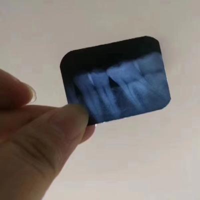 Cina Denti tenuti in mano X Ray Machine Wireless Medical Equipment di Digital di rappresentazione in vendita