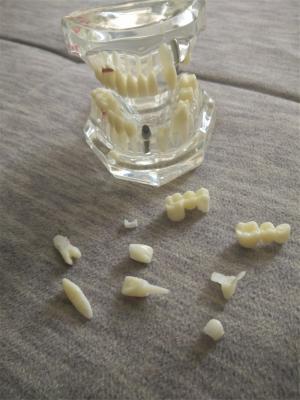 Cina I denti patologici di attività smontabile dei materiali dentari modellano in vendita
