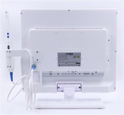 Cina Monitor a 17 pollici della macchina fotografica intraorale dentaria senza fili LED di Wifi Digital Mouthwatch in vendita