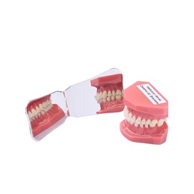 Cina Specchio intraorale bianco di fotografia dell'anti specchio dentario Endodontic orale della nebbia in vendita