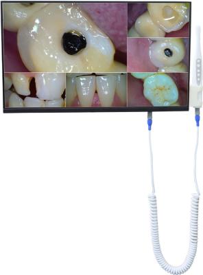 Cina Intra touch screen orale integrato a 21,5 pollici tutto della macchina fotografica in un PC Endoscrope dentario in vendita