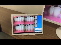 M-968 19inch screen with 5G WIFI intra oral camera