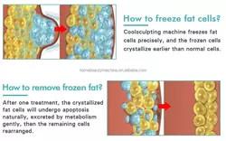 Cina Cryolipolysis che dimagrisce macchina in vendita