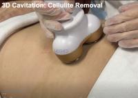 China Rf 40k Cavitation Machine Vacuum Body Shape Slimming Roller for sale
