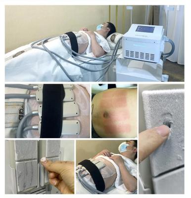 China Portable Fat Freezing Machine Slimming Fat Cellulite Removal Cryotherapy Device Cryo Plates for sale