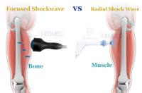 China Focal Focus Shockwave Soft Shock Wave Eswt Physiotherapy Device for sale
