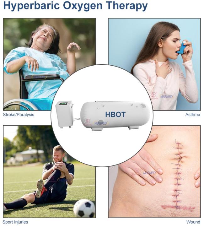 Camara Hiperbarica De Oxigeno Hyperbaric Chamber Home Oxygen Generator