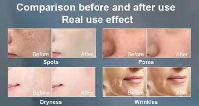 China Dpl Nir Skin Rejuvenation Ipl Hair Removal Machine Dpl Opt Acne Therapy Machine for sale