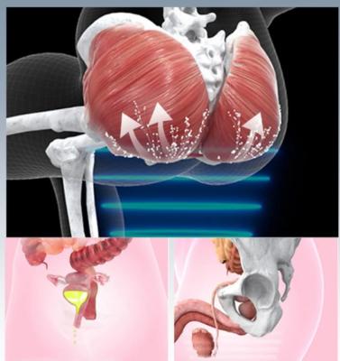 Cina Macchina per sedia di riparazione post-partum dei muscoli del pavimento pelvico EMS per muscoli del pavimento pelvico, incontinenza urinaria, sedia EMS in vendita