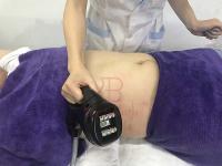 China Fat Burning EMShapeing Skin Tightening Iii Machine for sale