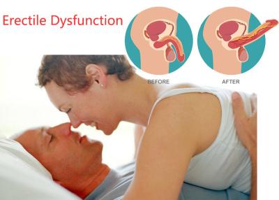 Cina Macchina di terapia di Shockwave di fisioterapia di disfunzione erettile in vendita