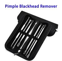 China Vacuum Suction Electric Blackhead Remover Private Label for sale