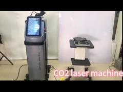 Fractieve CO2 laser huidherstel kooldioxide laser tube machine pigmentatieverwijder voor het gezicht