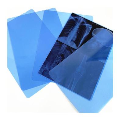 China Medical Use Digital Printing Film for sale