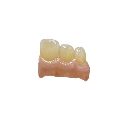 China Yellow Dental Ceramic Glaze Porcelain Powder CE For Ceramic Glazing for sale