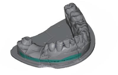 China LScan 8μm High Accuracy Dental Lab Scanner 10 Sec Full-Arch Scan with Full-Color Texture Open System for sale