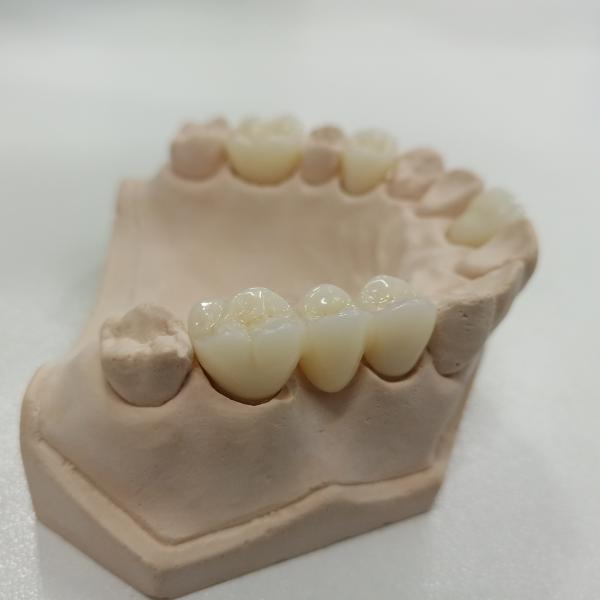 Quality 3D-Pro-ML All-in-One Zirconia 900-1200MPa Flexural Strength Full Contour Restoration for sale