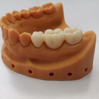 Cina Blocco di zirconia SHT a sinterizzazione rapida, 90 minuti di ripristino, protocollo a 1500 ° C in vendita