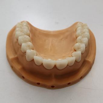 Cina Sistema completo in zirconia SHT, Blocchi + Liquidi di colorazione + Protocolli in vendita