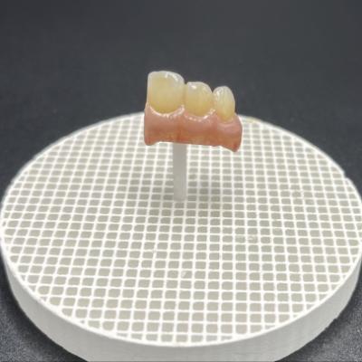 China Mengbaar Schaduwsysteem Pasta, Cervicale/Incisale Zone Formules, Voor PFM & Glaskeramiek Te koop