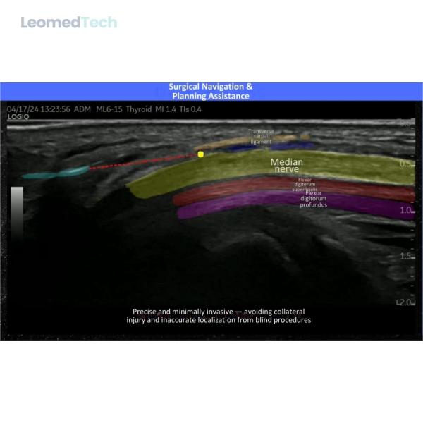 Quality Portable AI-Powered Ultrasound System with Real-Time Guidance for sale