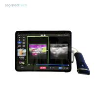 Quality AI Ultrasound Guidance Tablet System for Multidisciplinary Diagnosis with Real for sale