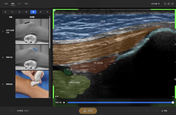 Quality AI‑Powered Ultrasound Software for Diagnostic Analysis and Surgical Guidance for sale