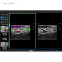 Quality AI‑Powered Ultrasound Software for Diagnostic Analysis and Surgical Guidance for sale