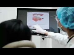 Vision Premium Top Medische tandheelkundige afdruk Intraorale Scanner OEM Scan 33 Nieuwe generatie.