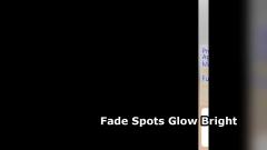 Whitening Serum For Freckles & Dark Spots