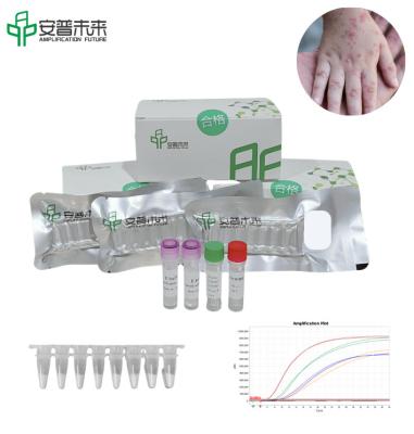 中国 超敏感DNA同熱増幅キット 最低レベルでも検出 販売のため