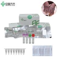 China Mpox multi-enzyme constant temperature rapid nucleic acid amplification overall solution for sale