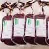 Quality Medical Supply Sterile Disposable Sample Blood Bag for sale