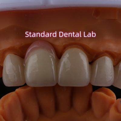 China Sterk biocompatibel PFZ porseleinen gelaagd zirconia met roze kauwgom Te koop