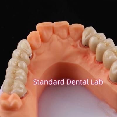 Quality Digital Non Precious Metal Porcelain Crown PFM Bridge Dental for sale