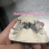 China Cobalt Chrome Cast Frame Partial Denture Vitallium 2000 for sale