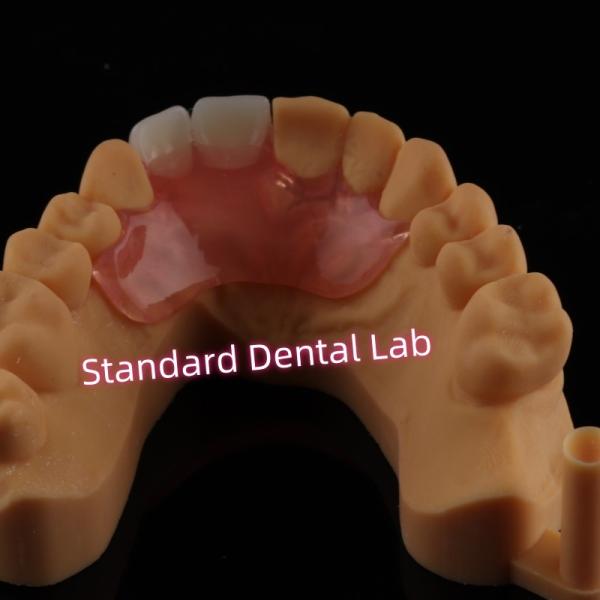 Quality Dental Valplast Flexible Flipper Dentures Removable Partial Denture for sale