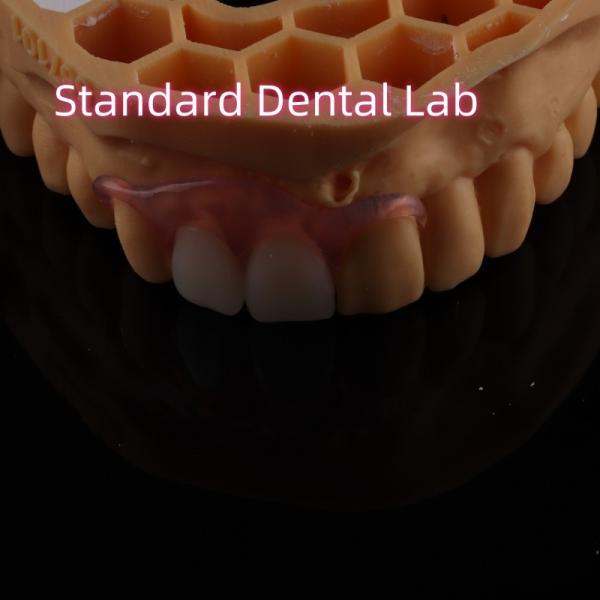 Quality Dental Valplast Flexible Flipper Dentures Removable Partial Denture for sale