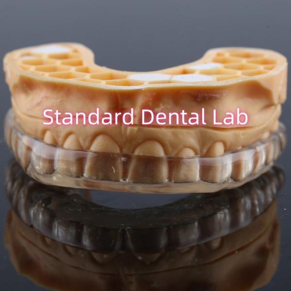 Quality Professional Custom Anti Snoring Dental Guard Upgraded Night Mouthguard For Teeth Grinding for sale
