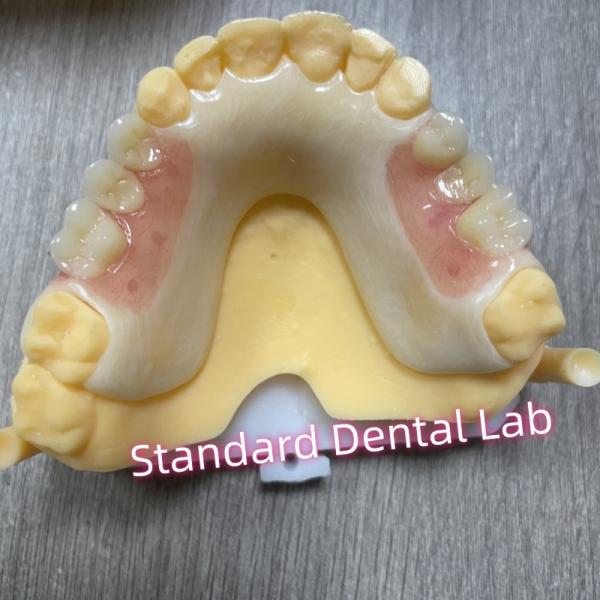 Quality Upper Tooth Shade Acetal Framework Acrylic Clasp Removable Partial Dentures for sale