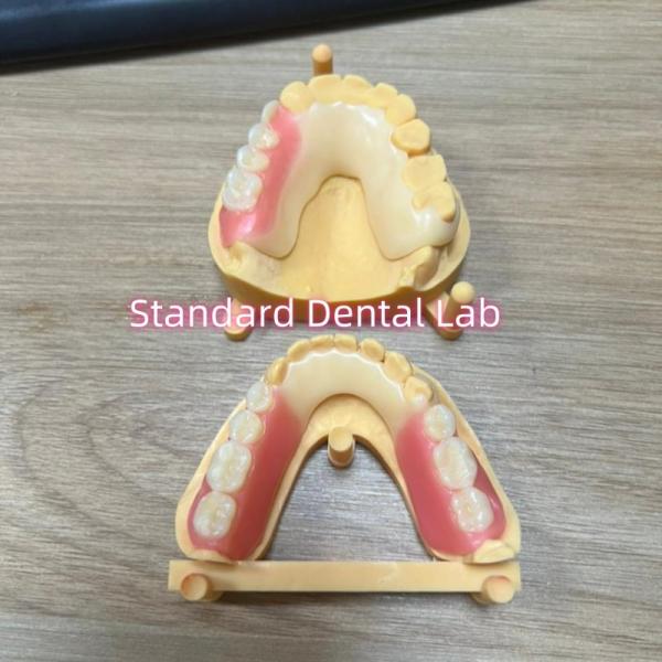Quality Esthetic Tooth Shade Acetal Framework  Tooth Coloured Clasps Ivoclar Set Up for sale