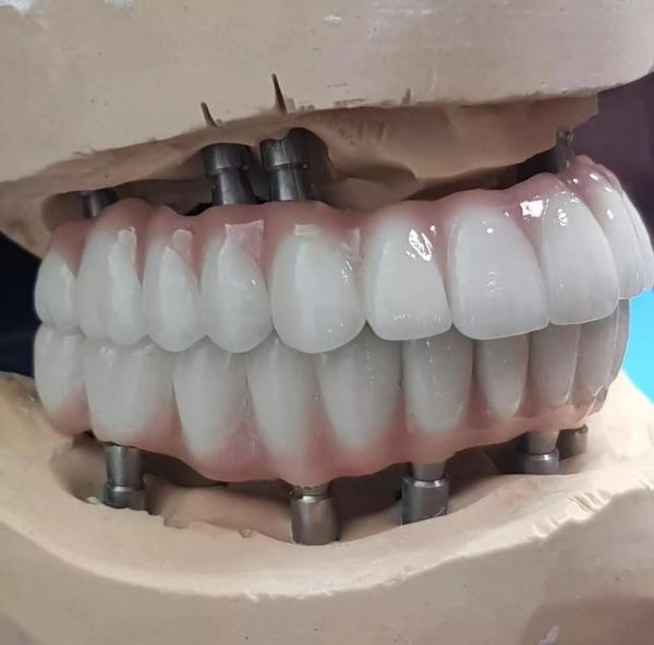 Quality Precision-Crafted Zirconia Implant Screw Cement Retained for Natural-Looking for sale
