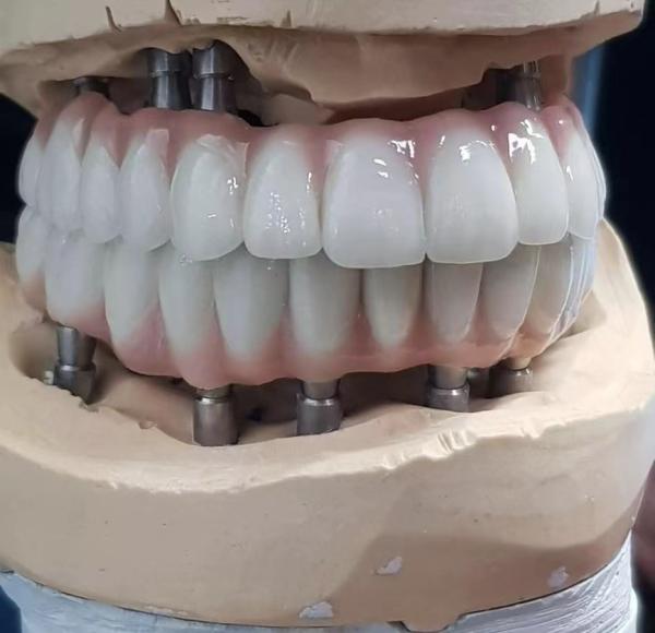 Quality Precision-Crafted Zirconia Implant Screw Cement Retained for Natural-Looking Teeth for sale