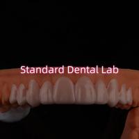 Quality Dental Snap On Smile Veneers For Teeth Discolorations / Gaps for sale
