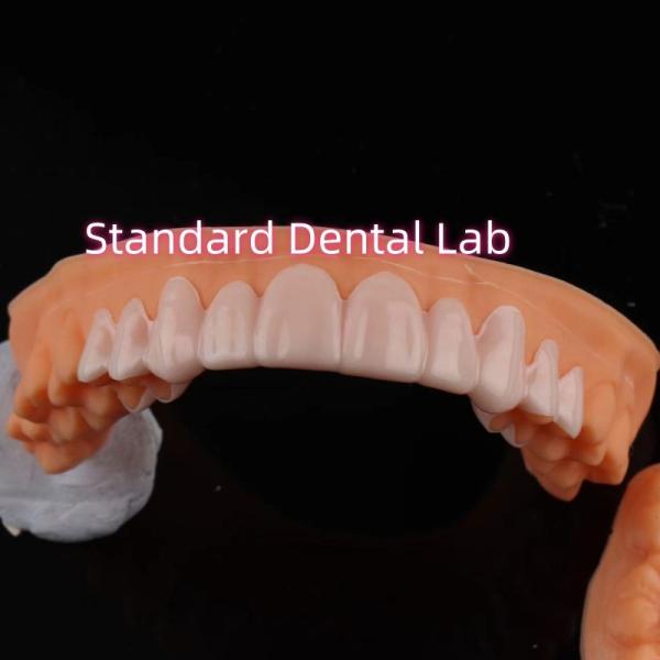 Quality Dental Snap On Smile Veneers For Teeth Discolorations / Gaps for sale