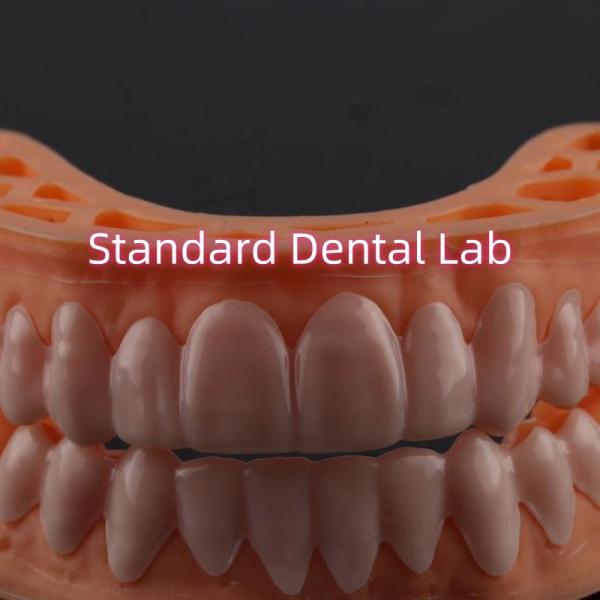 Quality OEM ODM Pop On Veneers Custom Made Veneers Snap On Smile for sale