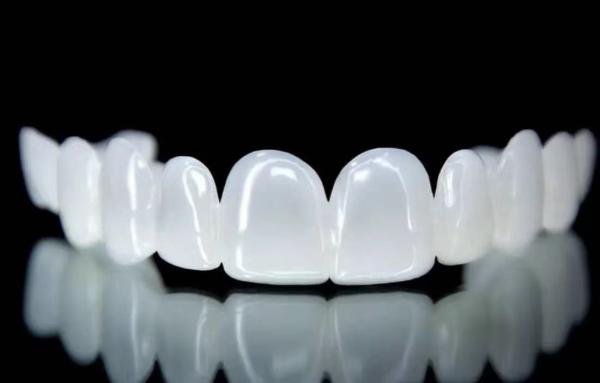 Quality Removable Snap On Veneers Snow White Shade Good Fit Dental Design Service for sale