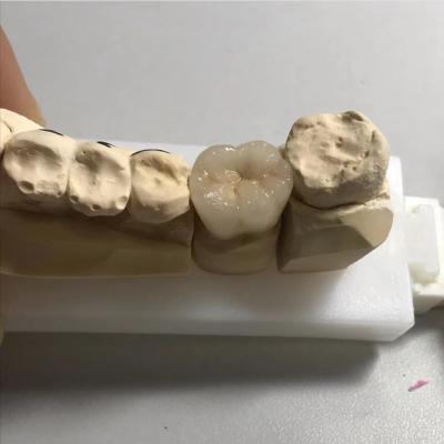 China ISO FDA CE Dental Metal Post And Core Crown PFM Good Fit for sale